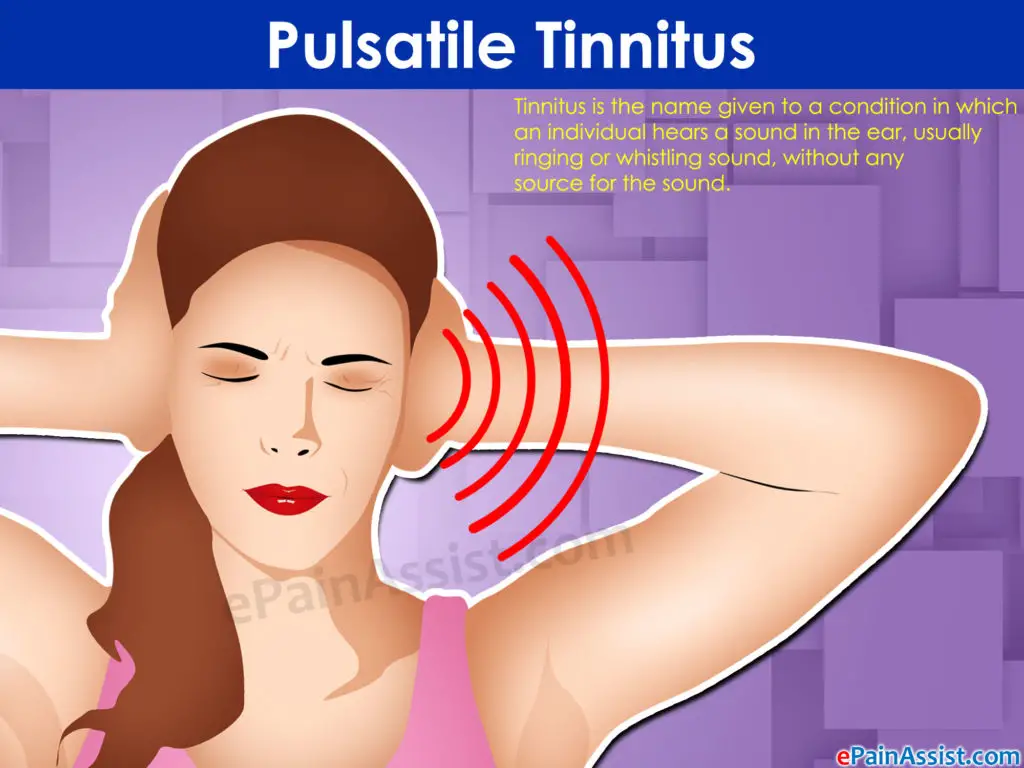 The Cause of Pulsatile Tinnitus Explained - Pulsatile Tinnitus